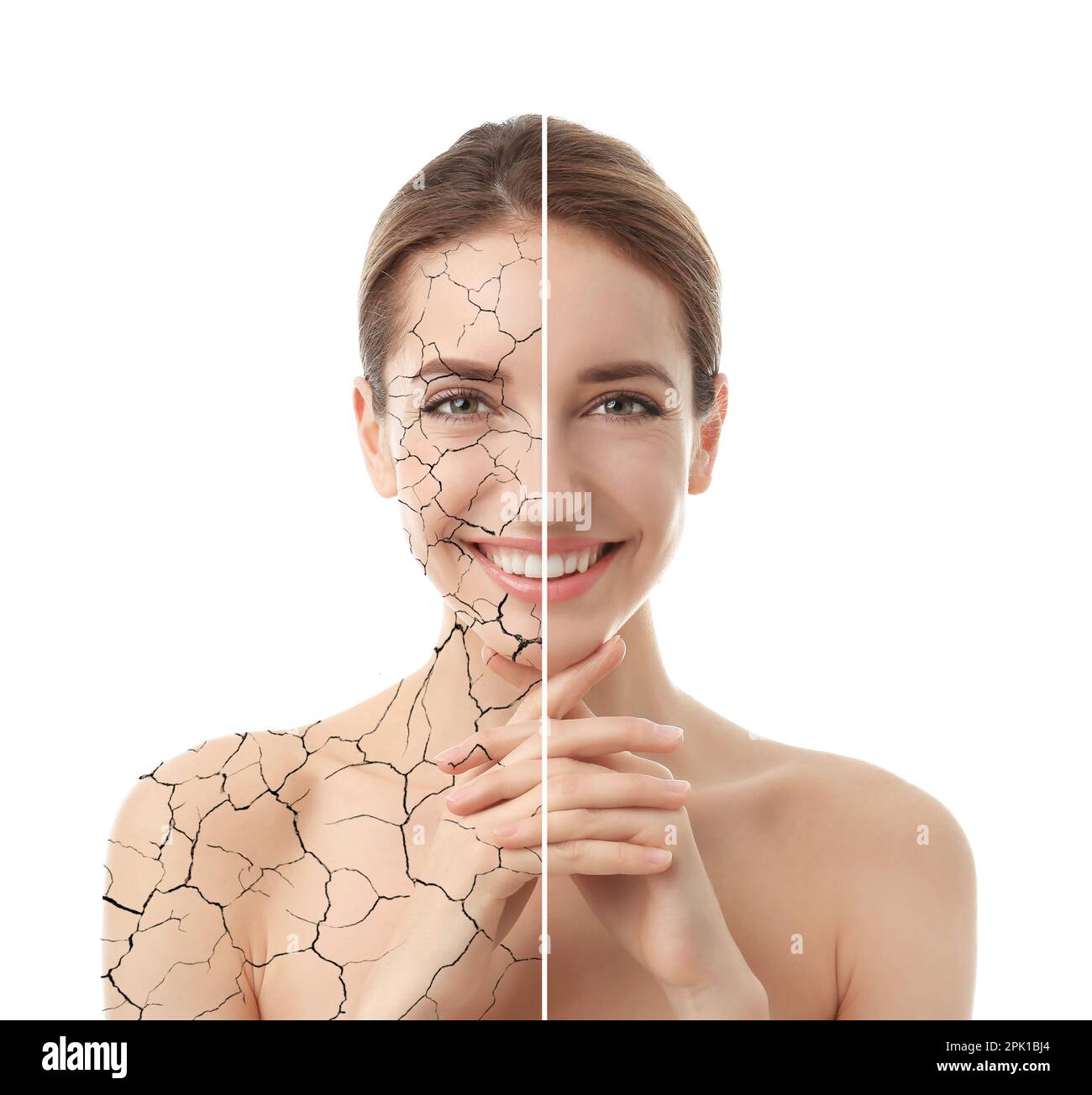 Collage with photos of woman having dry skin problem before and after ...