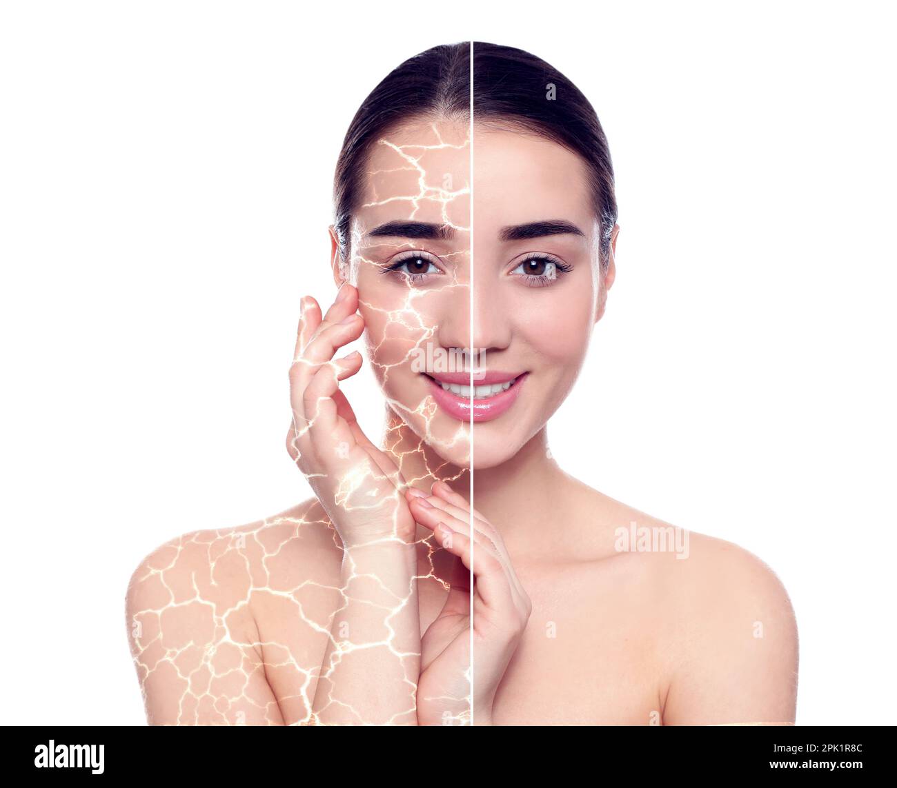 Collage with photos of woman having dry skin problem before and after ...