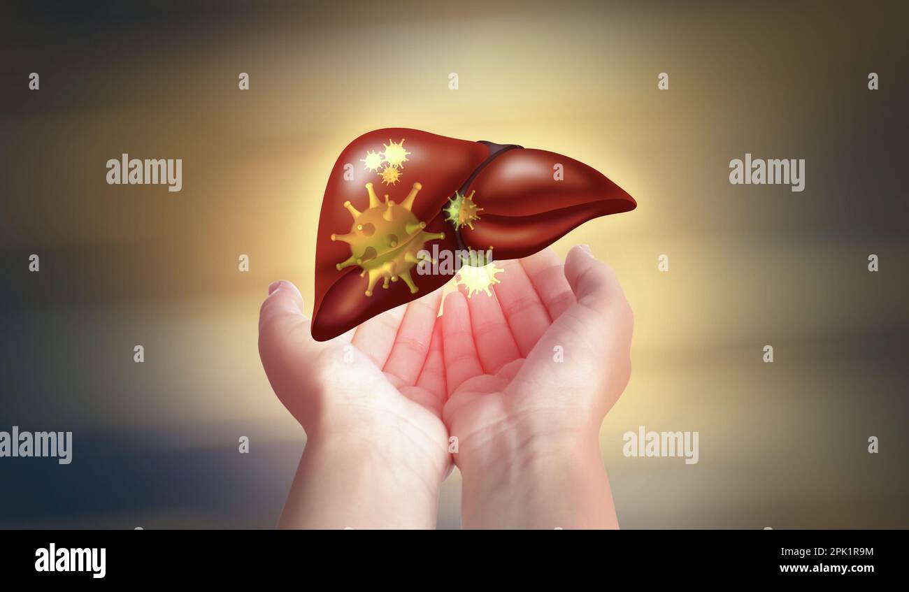 Unhealthy Human Liver