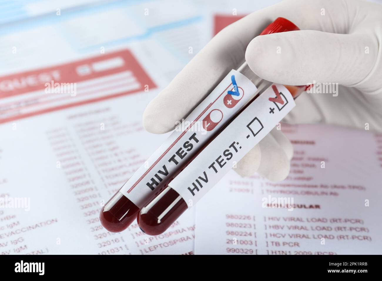 Lab test labels hi-res stock photography and images - Alamy