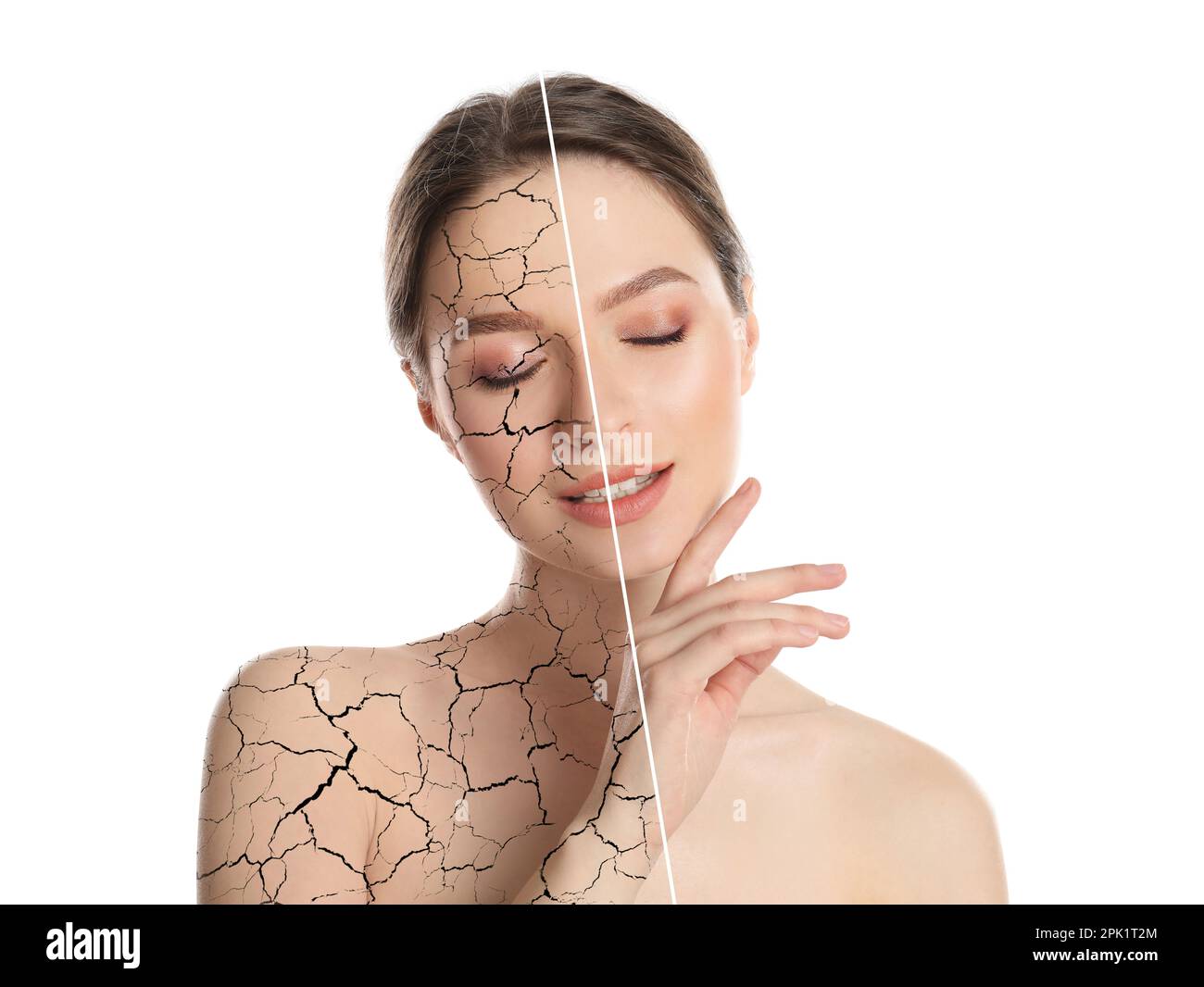 Collage with photos of woman having dry skin problem before and after ...