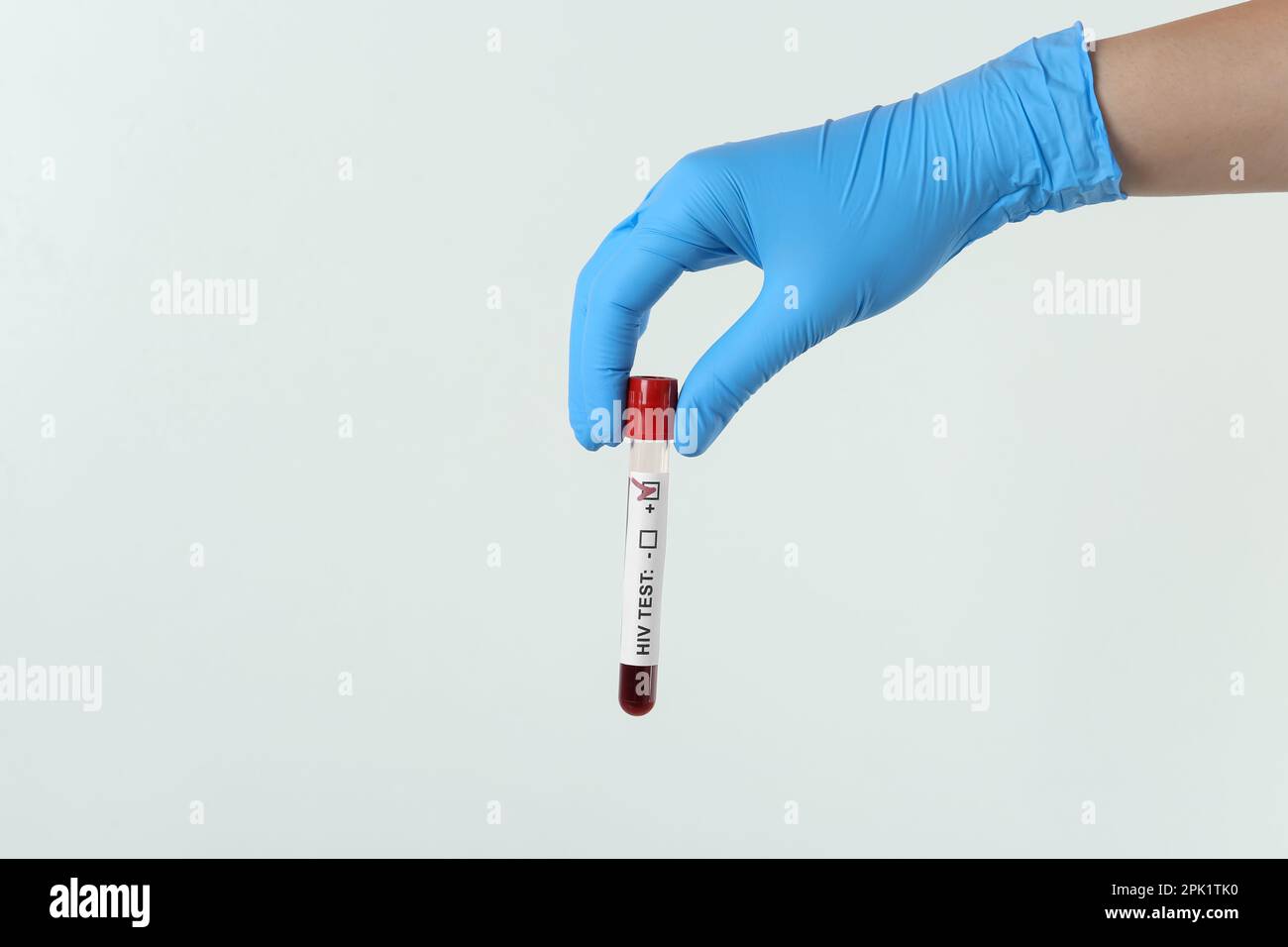 Scientist holding tube with blood sample and label HIV Test on light ...