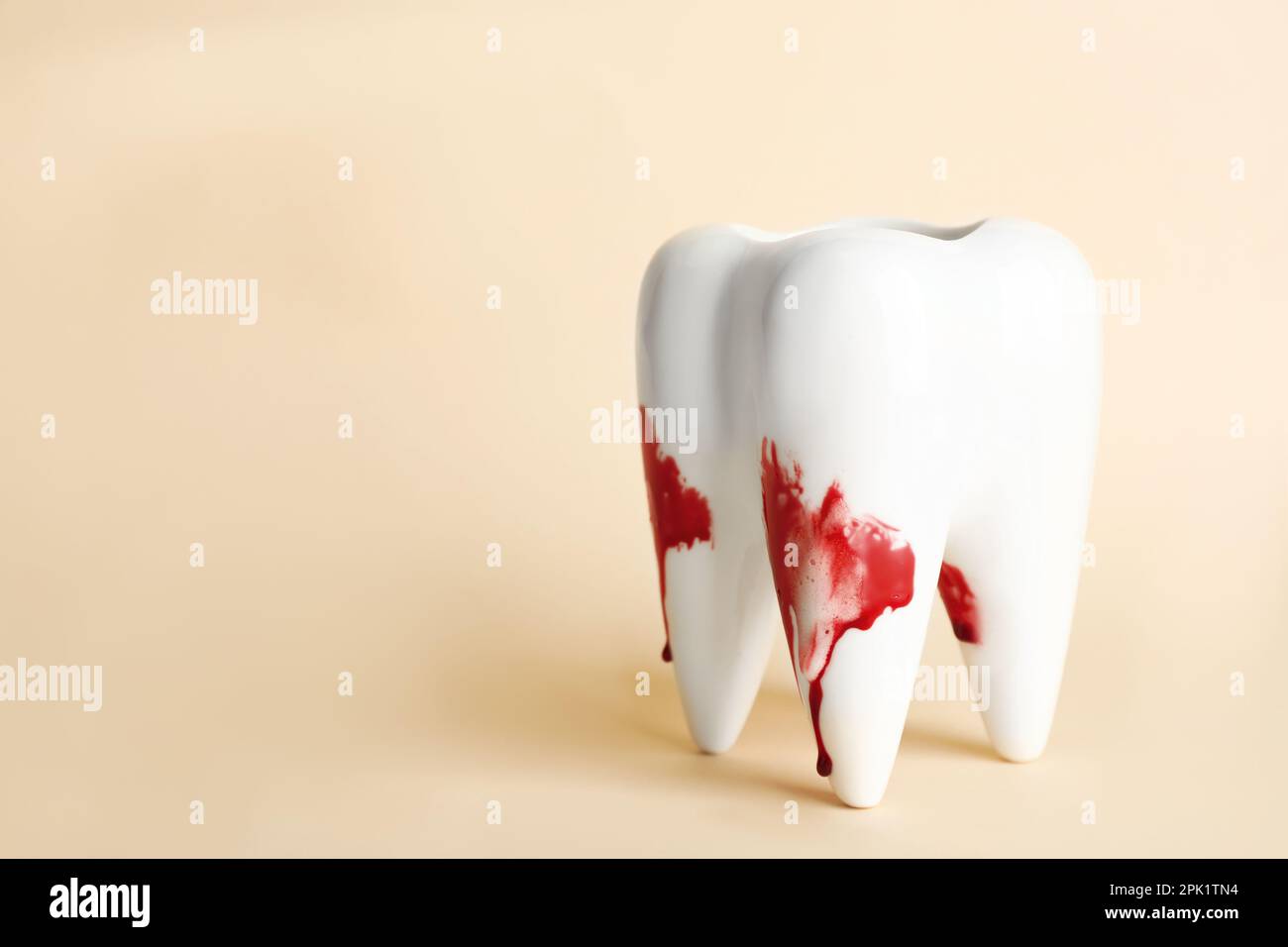 Tooth model with blood in toothpaste foam on beige background, space ...