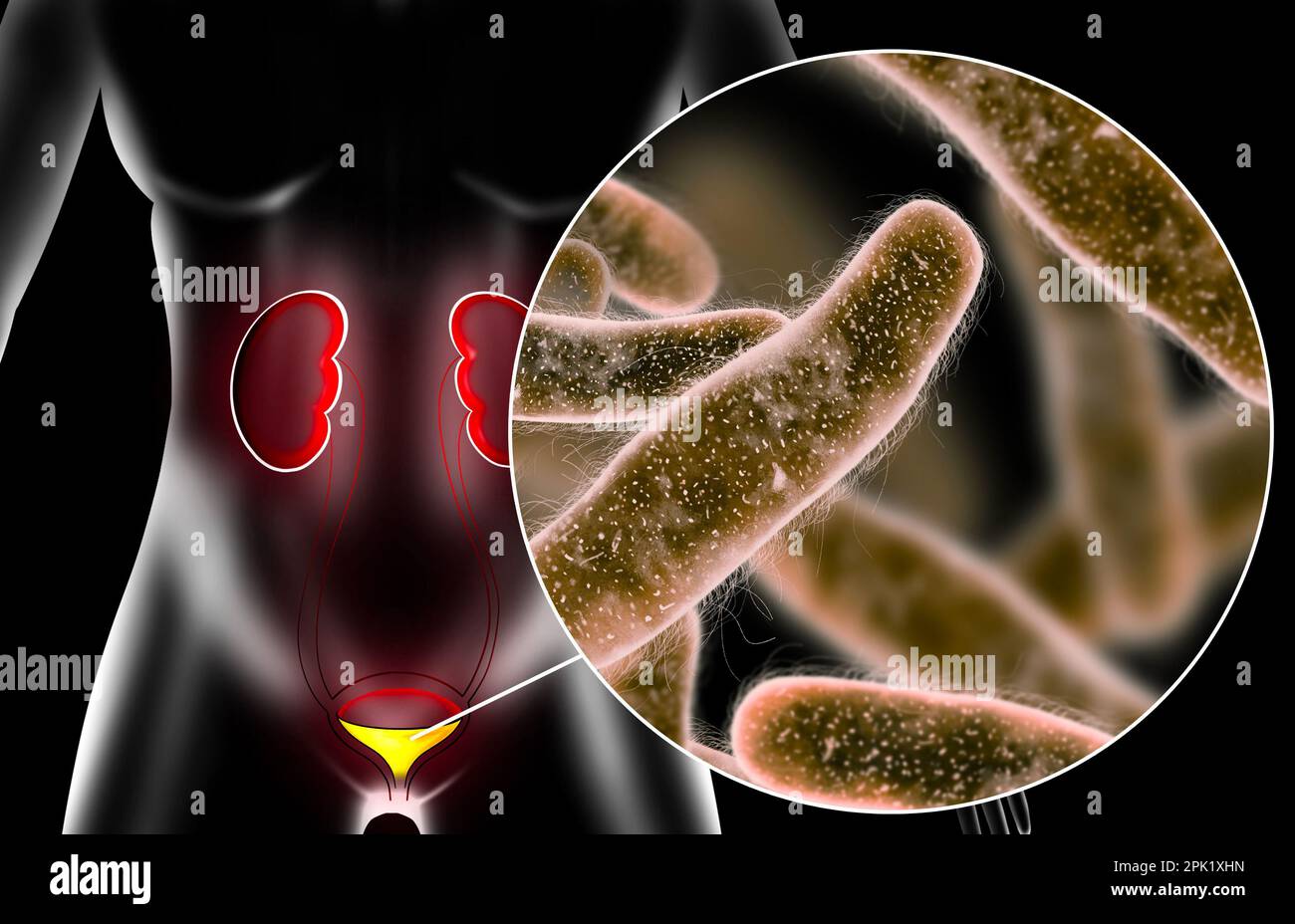 Illustration of woman suffering from cystitis. Urinary infection Stock ...