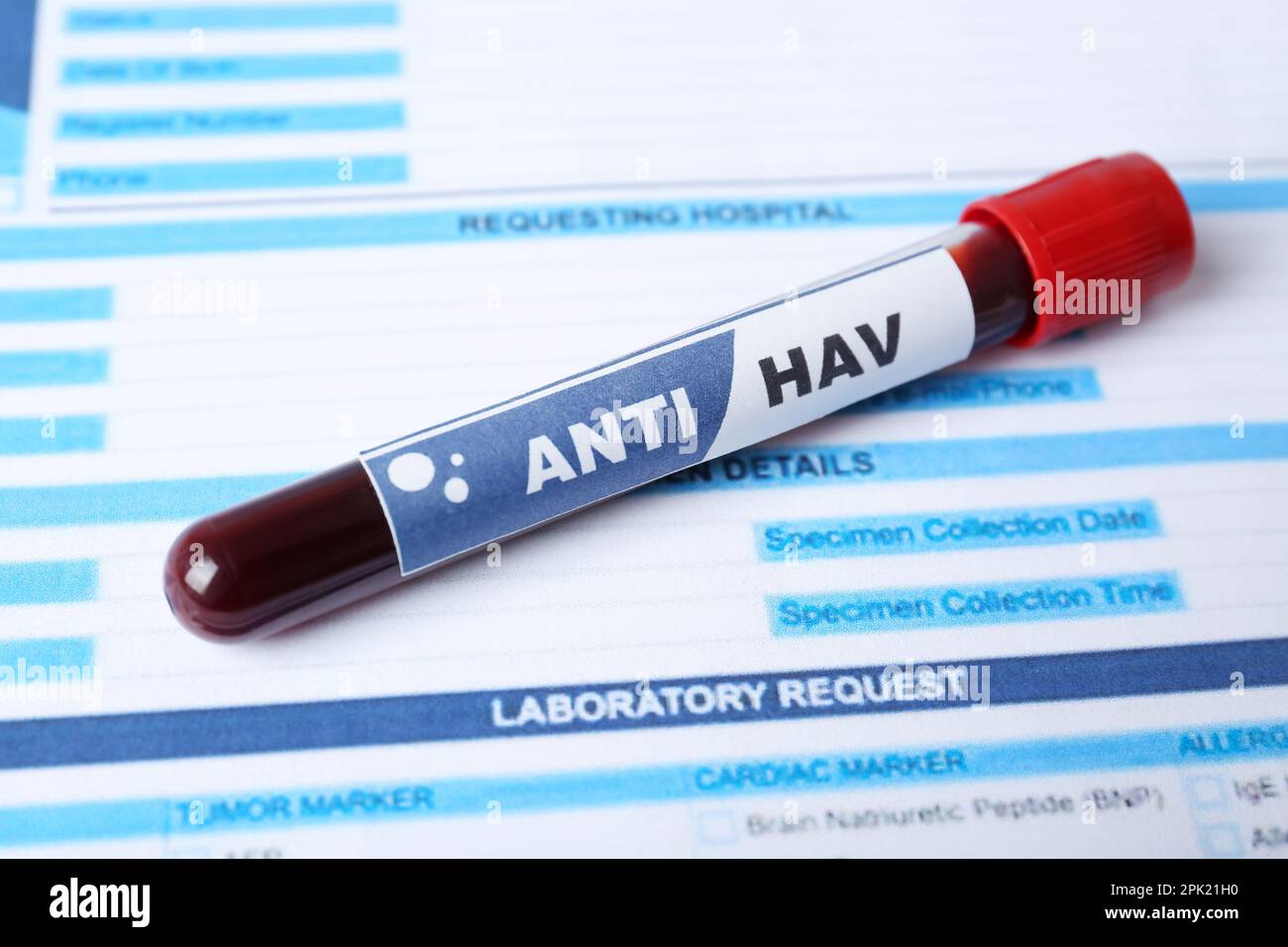 Laboratory test form hi-res stock photography and images - Alamy