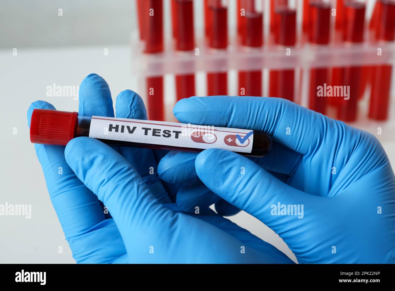 Scientist holding tube with blood sample and label HIV Test at table ...