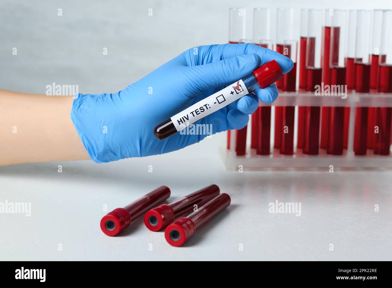Scientist holding tube with blood sample and label HIV Test at white ...