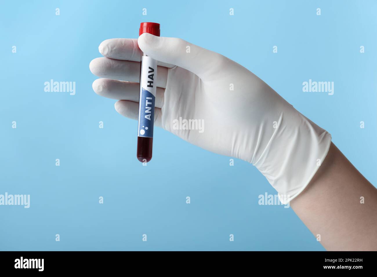 Scientist holding tube with blood sample and label Anti HAV on light ...