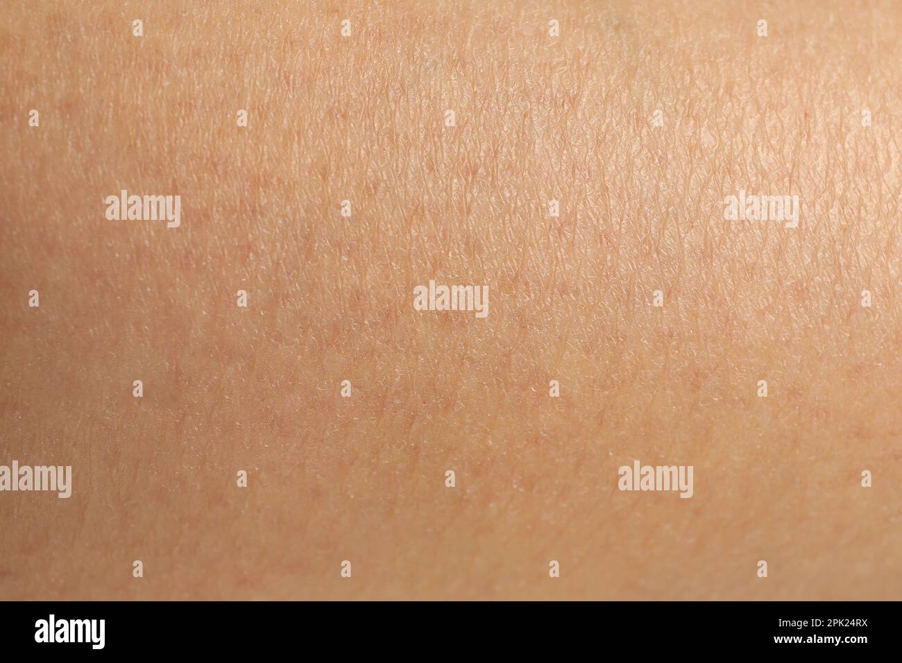 Texture of clean human skin, closeup view Stock Photo - Alamy