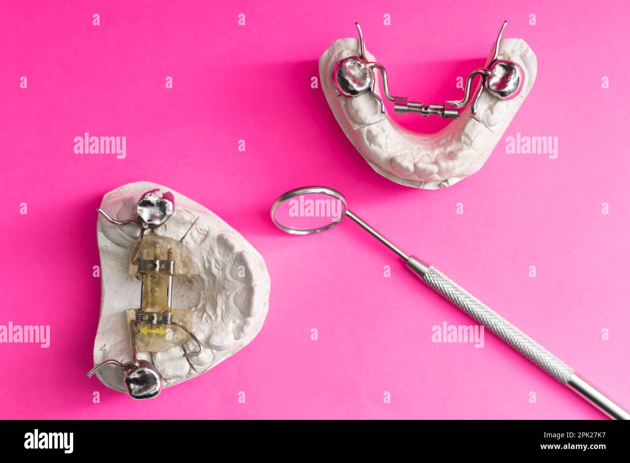 Dental casting gypsum model plaster cast stomatologic human jaws ...