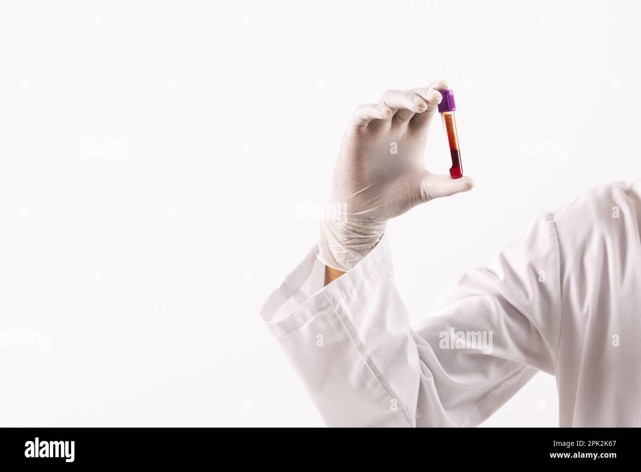 Hand in white surgical glove holding blood sample tube, on white ...