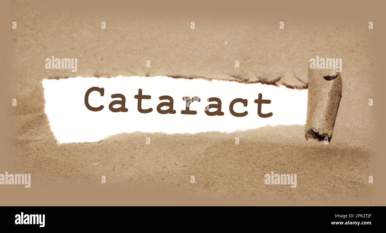 Cataract word written under brown torn paper. Eyes healthcare concept ...
