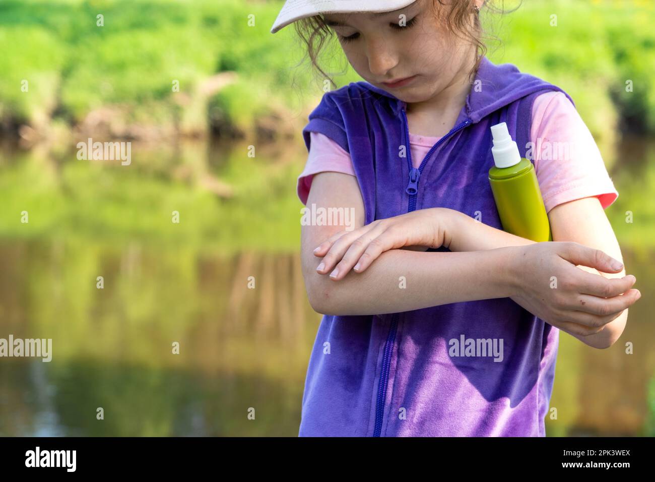 Girl sprays mosquito spray on the skin in nature that bite her hands ...