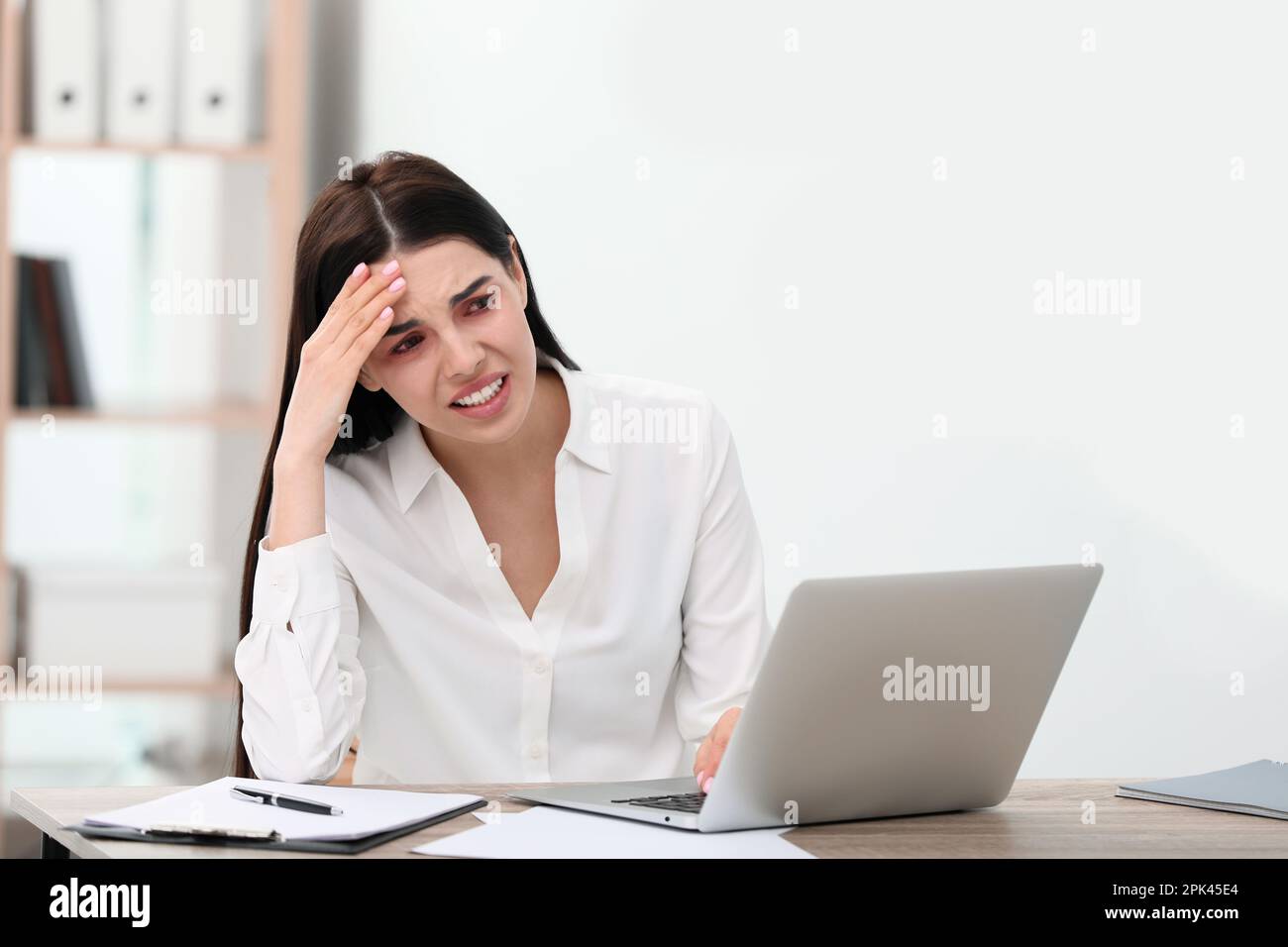 Tired woman with red eyes at workplace in office Stock Photo - Alamy