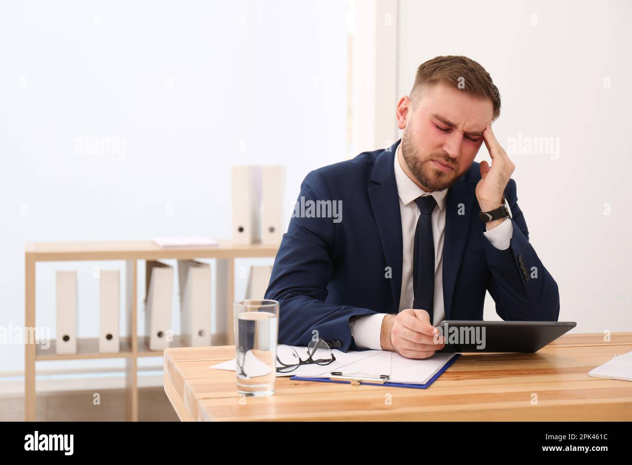 Tired man with red eyes at workplace in office Stock Photo - Alamy
