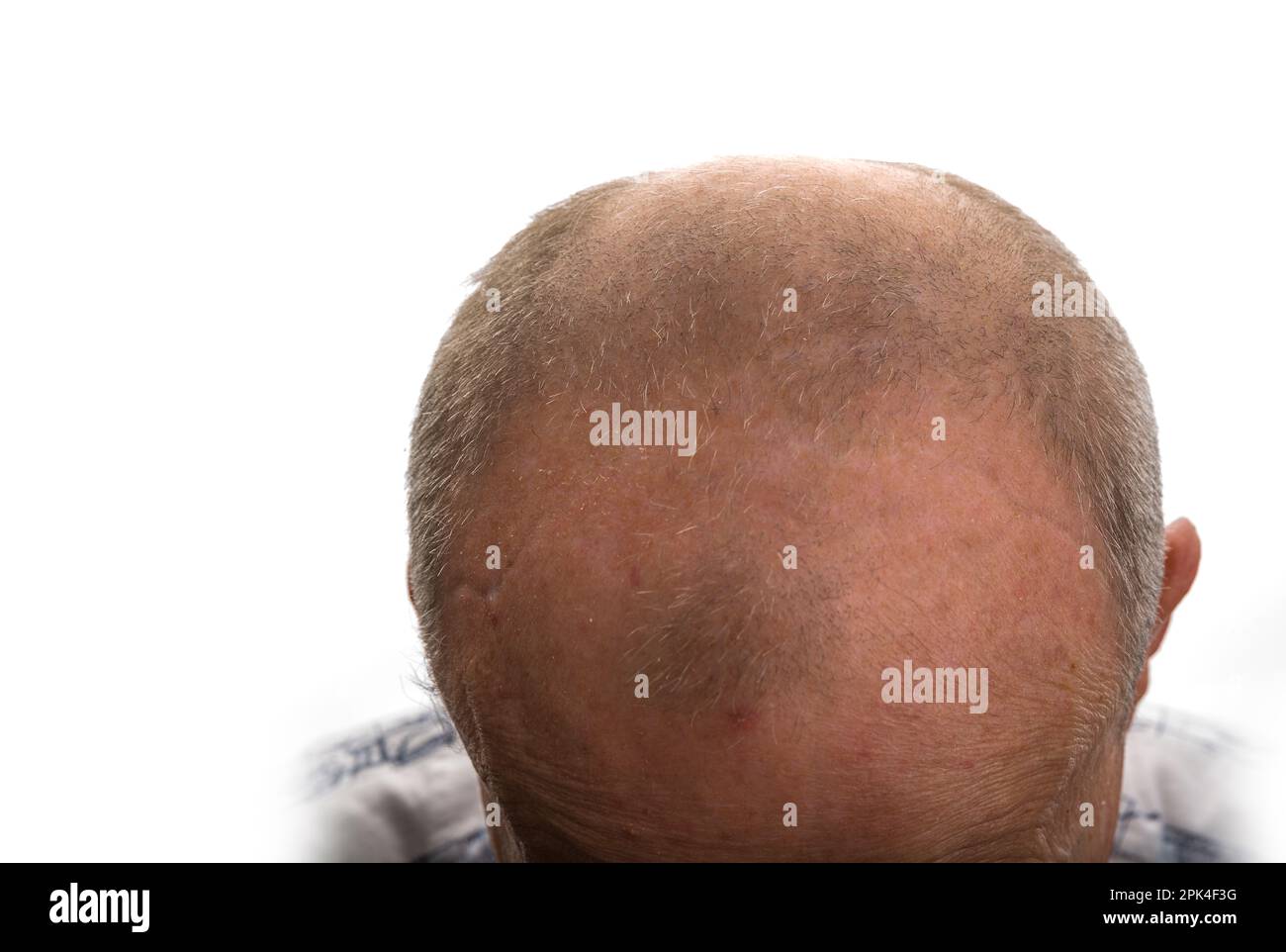 Top of a bold head of an old male on a white Stock Photo - Alamy