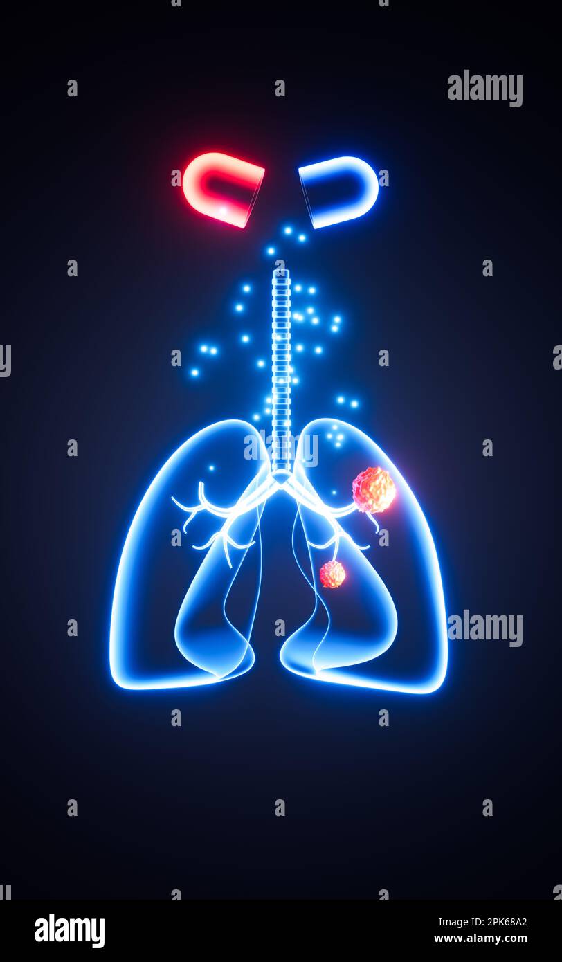 Drug treatment of lung disease, lung treatment, lung cancer, 3d ...