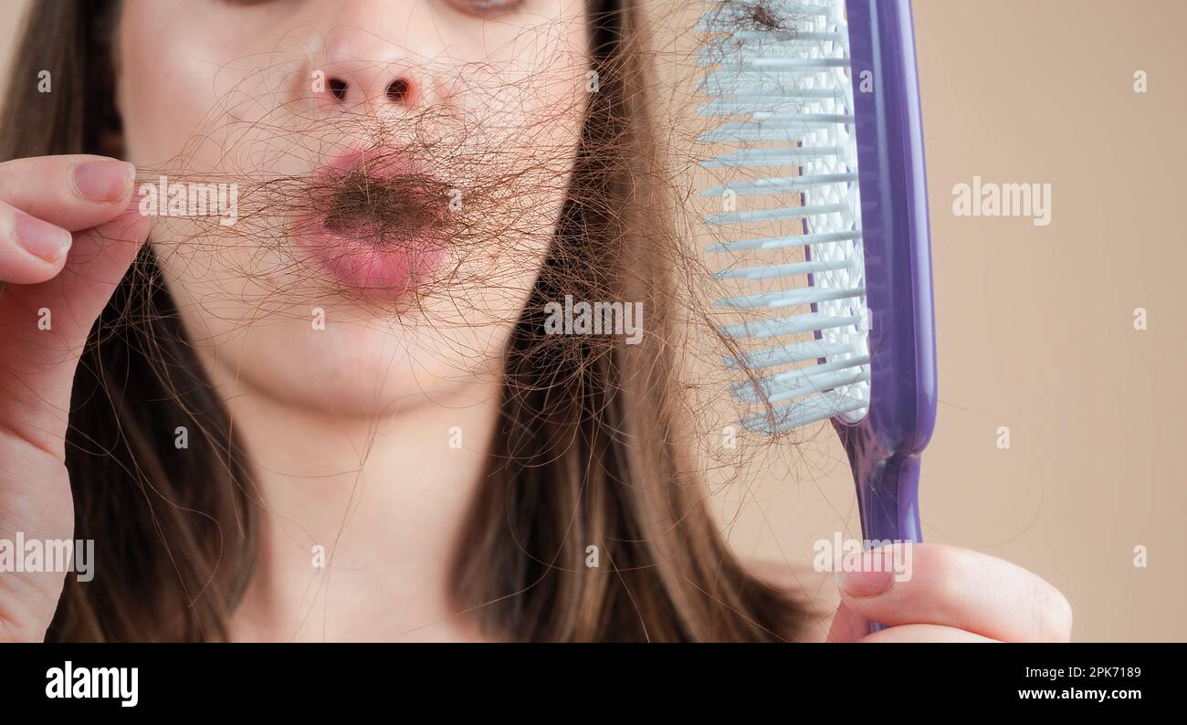 Hair loss. Woman is upset of hair loss. Portrait of sad girl with ...