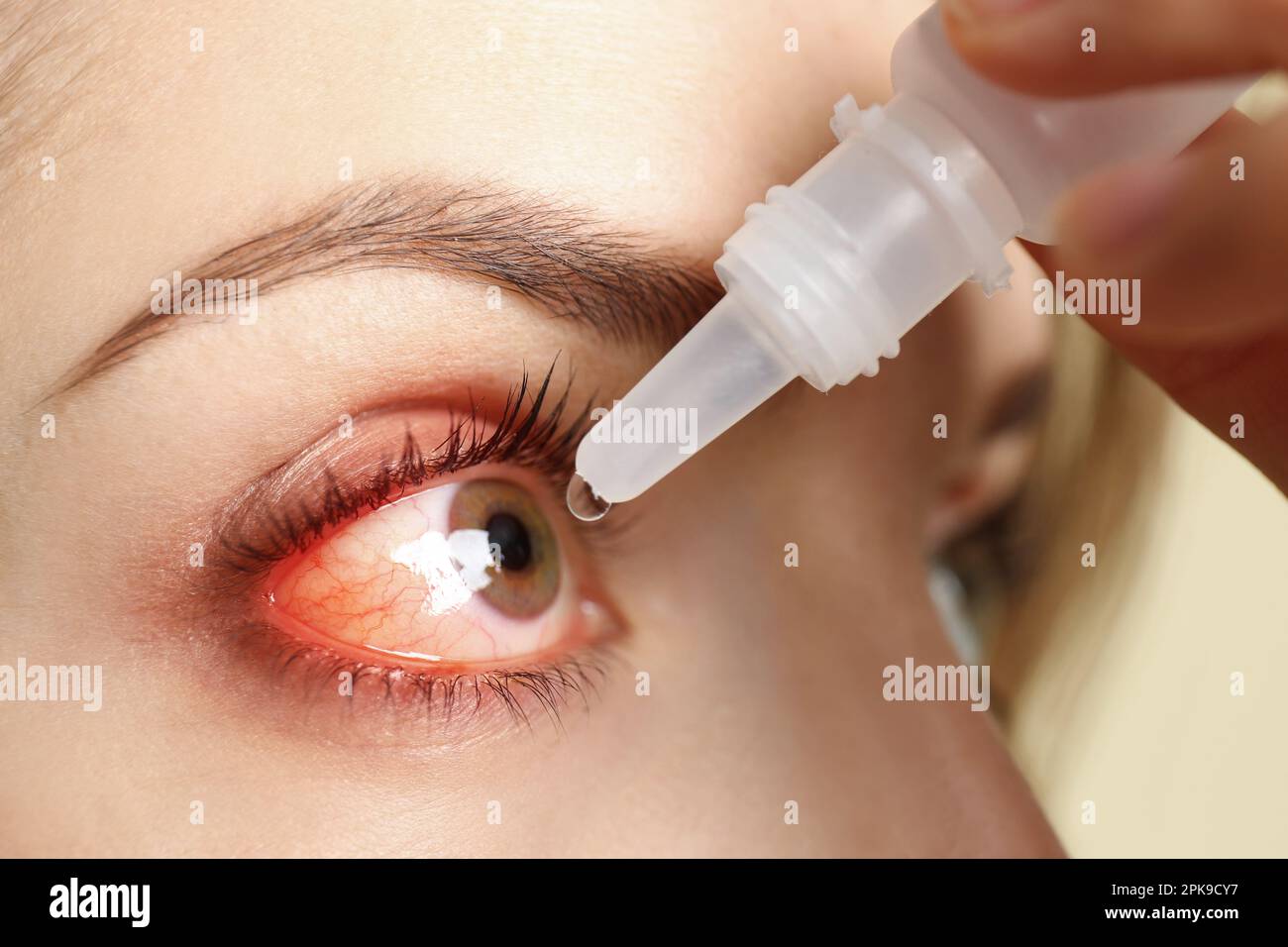 Inflamed eyes hi-res stock photography and images - Alamy