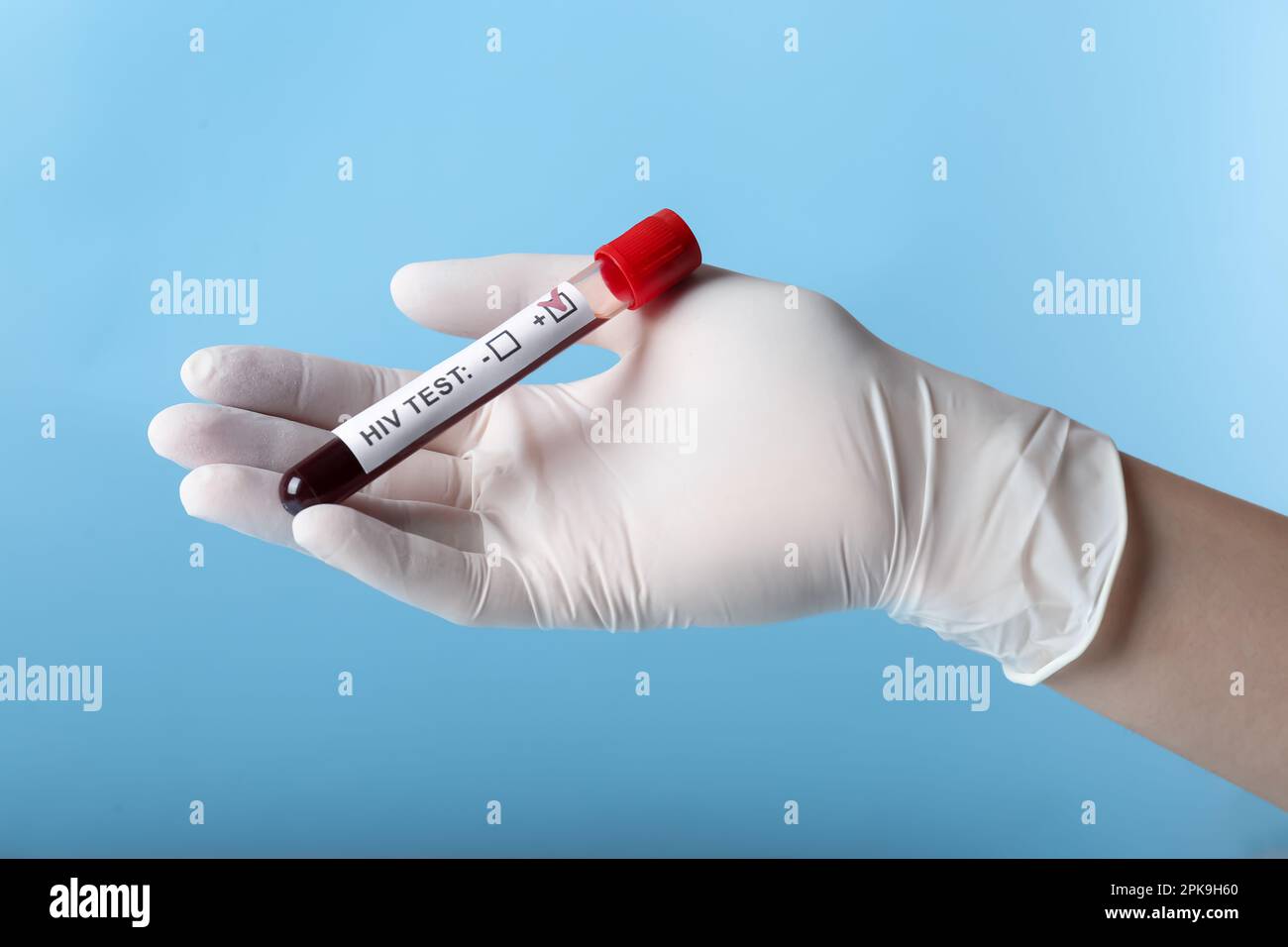 Scientist holding tube with blood sample and label HIV Test on light ...