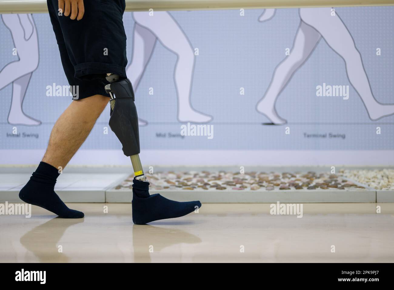 Athlete man with prosthetic leg walking at health care center Stock ...