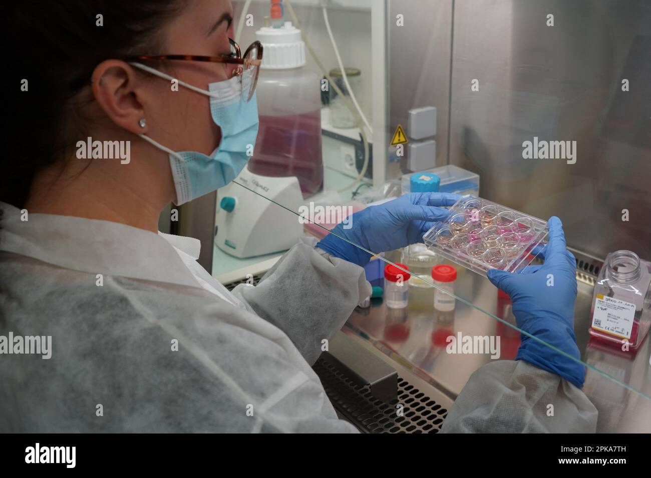 Research on chronic bacterial infections within Inserm. PhD student ...