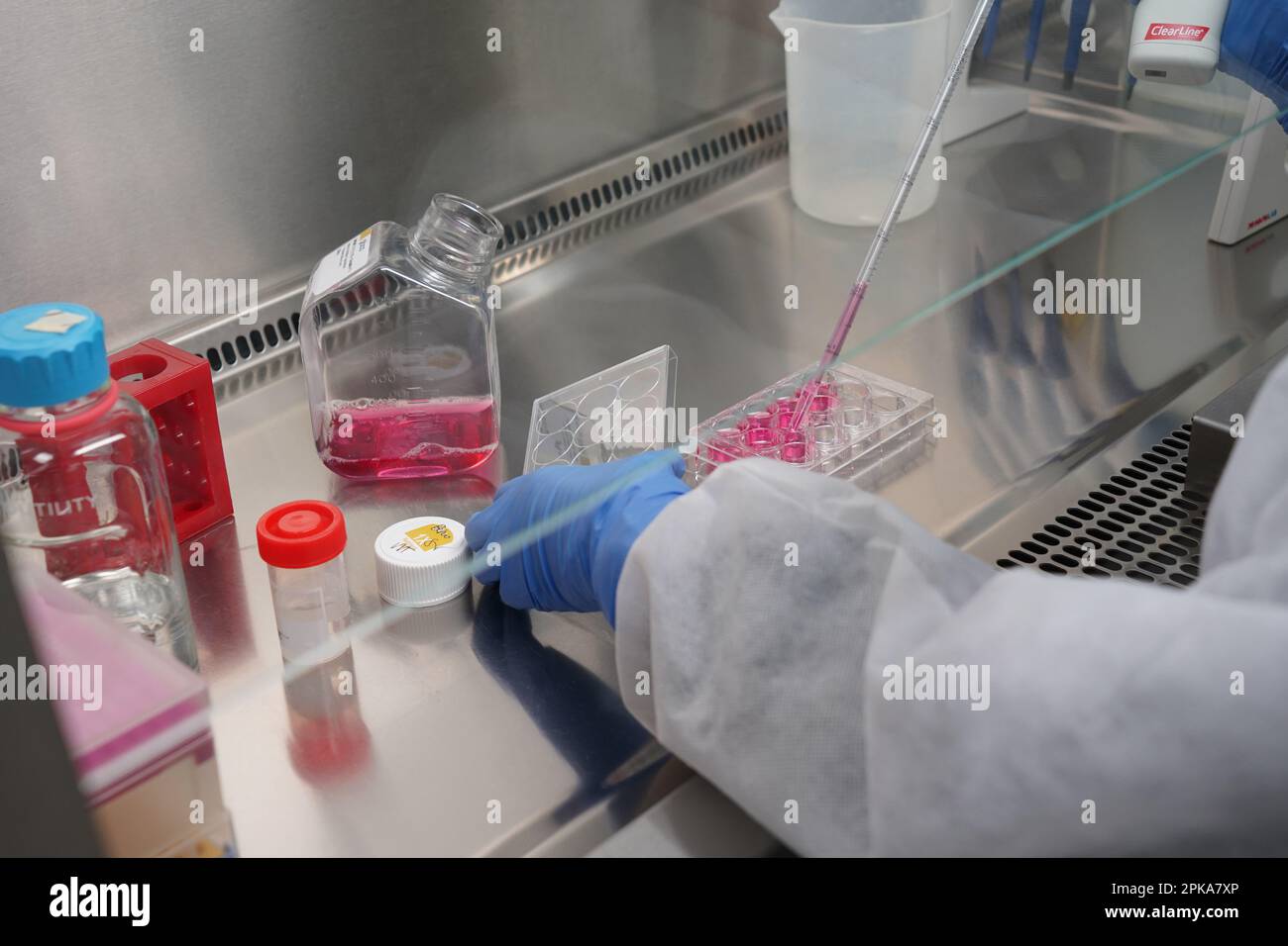 Research on chronic bacterial infections within Inserm. PhD student ...