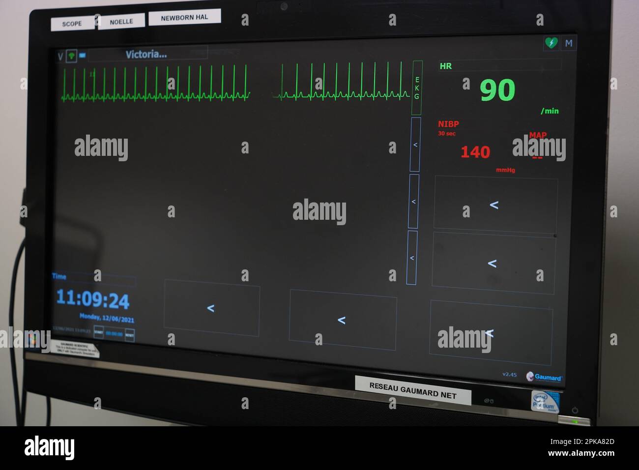 Students facing a post natal emergency follow procedures on a mannequin ...