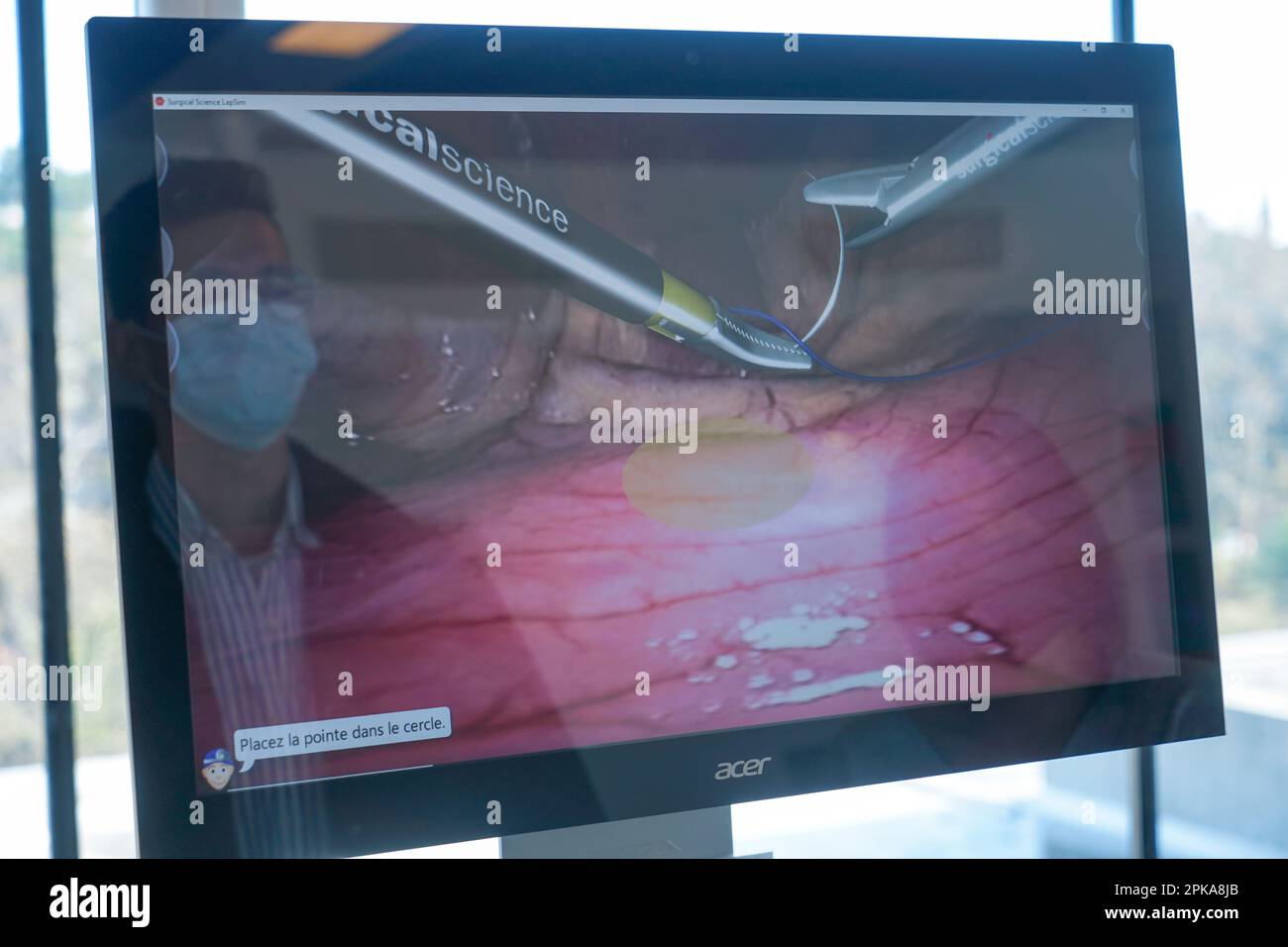 Acute myeloblastic promyelocytic leukemia hi-res stock photography and ...