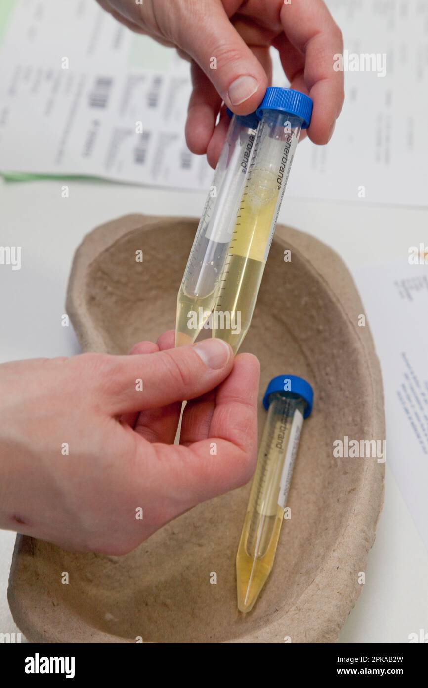 Fetal medicine: amniocentesis and study of the karyotype Stock Photo ...