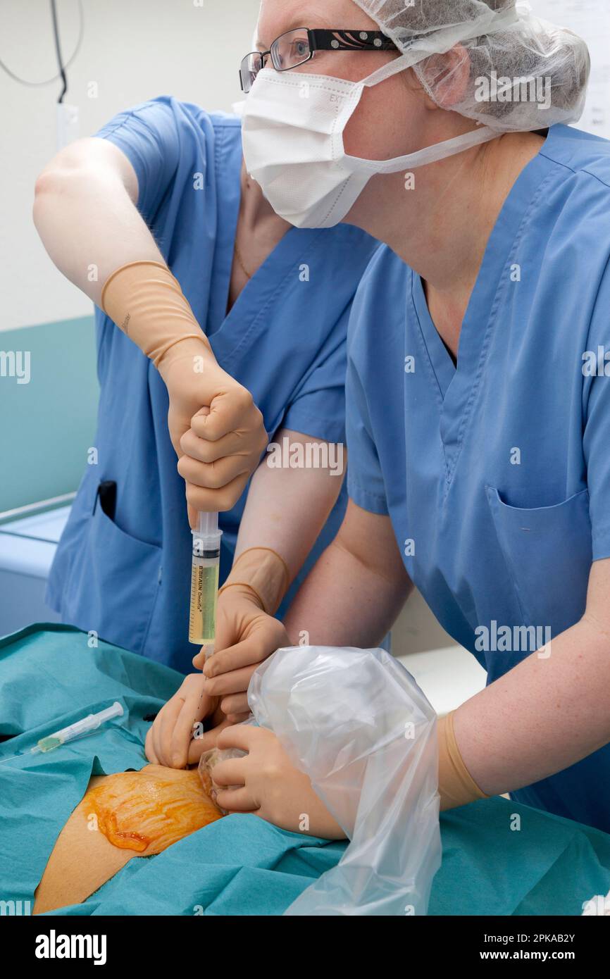 Fetal medicine: amniocentesis and study of the karyotype Stock Photo ...