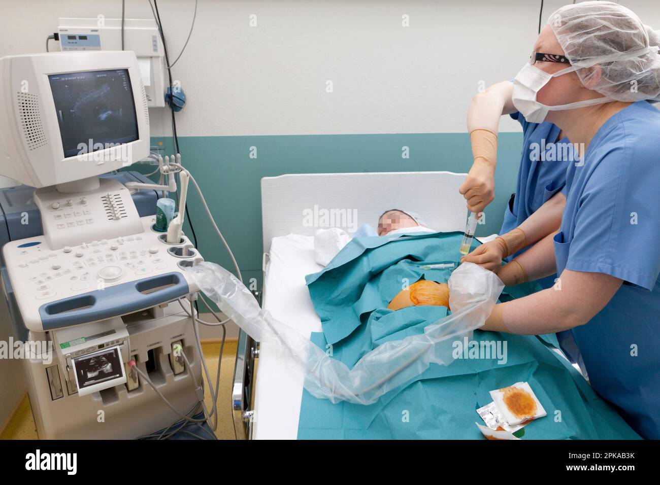 Fetal medicine: amniocentesis and study of the karyotype Stock Photo ...