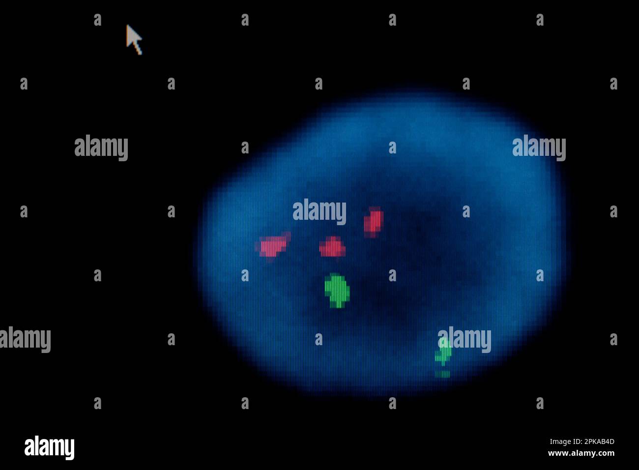 Cytogenetics laboratory, prenatal diagnosis by medical imaging FISH ...