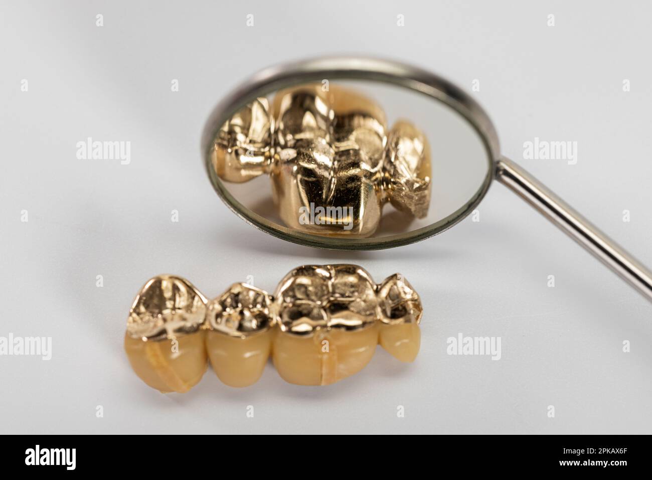 Mouth mirror, used partially veneered dental bridge, detail, symbol ...