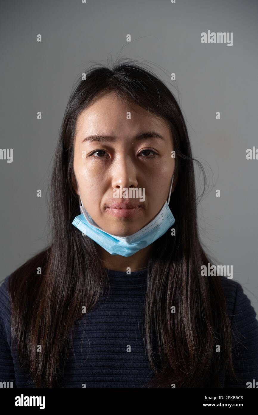 Skin irritation due to wearing a mask Stock Photo - Alamy