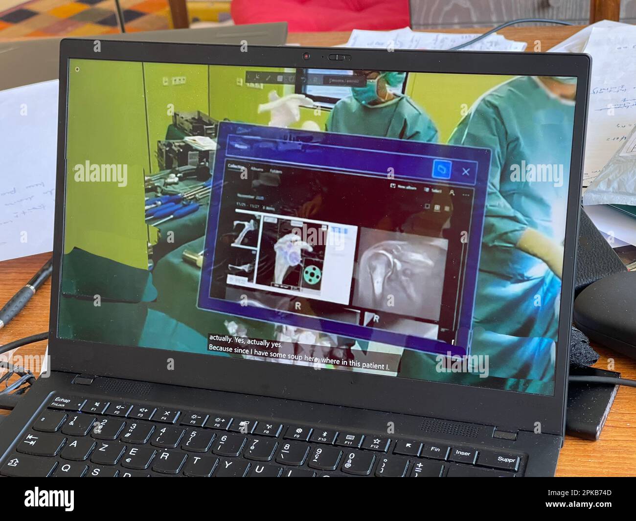 Doctors assisting in a remote shoulder operation from a computer Stock ...