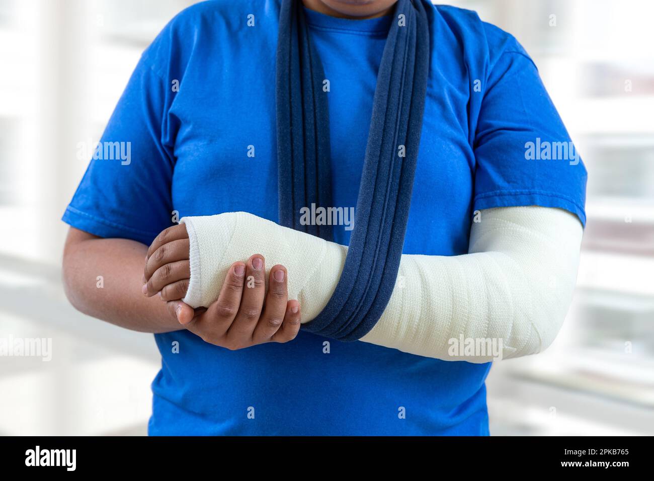 Young mixed-race boy with his arm plastered Stock Photo - Alamy