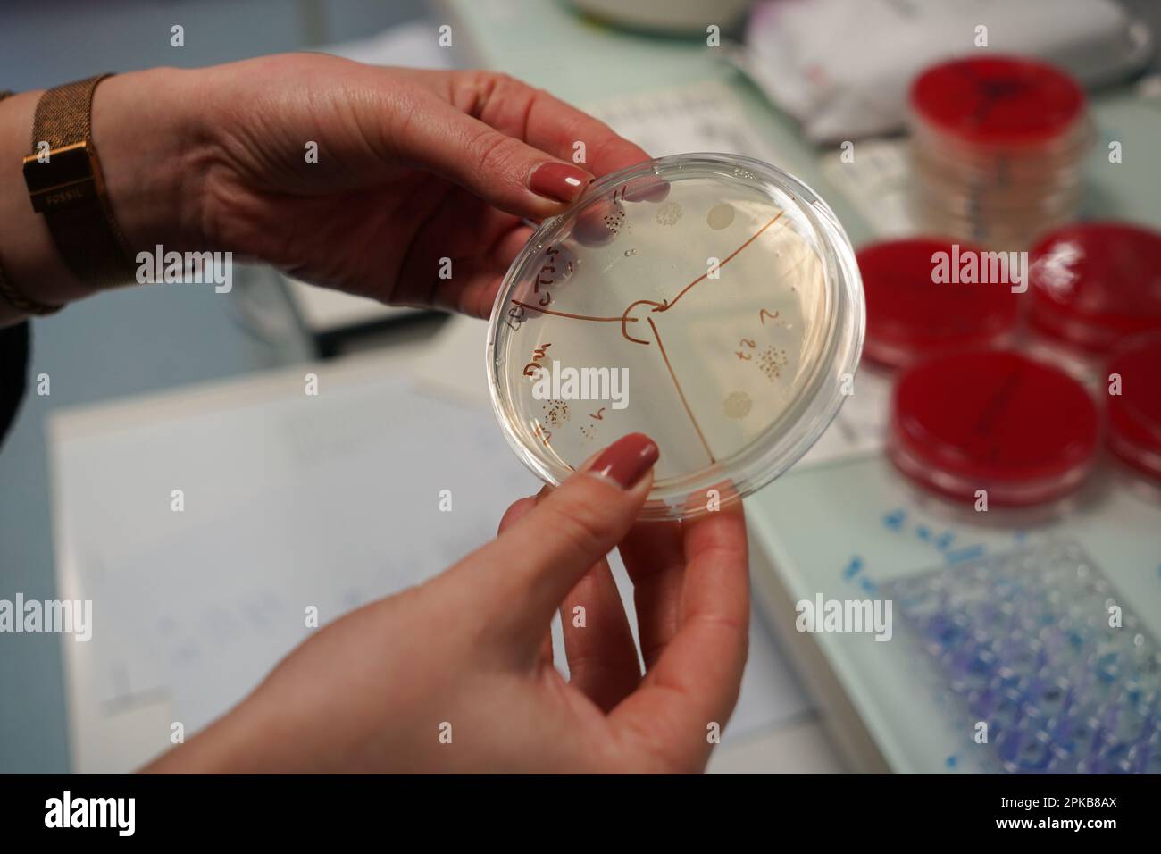Research on chronic bacterial infections within Inserm. Student working ...