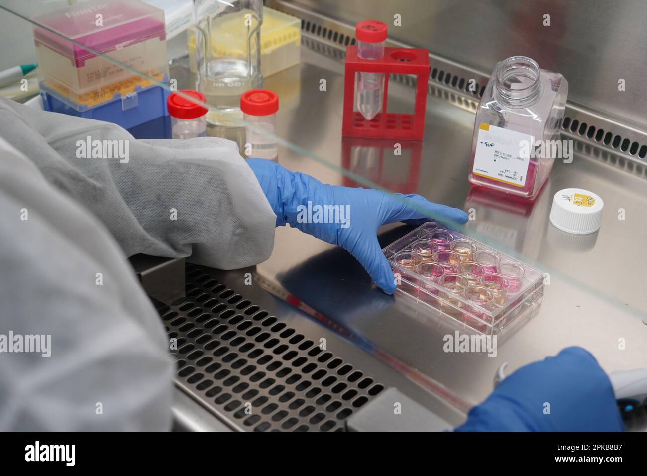 Research on chronic bacterial infections within Inserm. PhD student ...