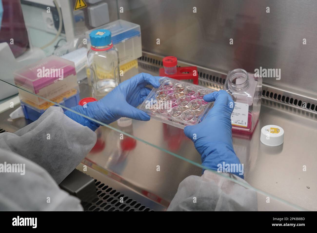 Research on chronic bacterial infections within Inserm. PhD student ...