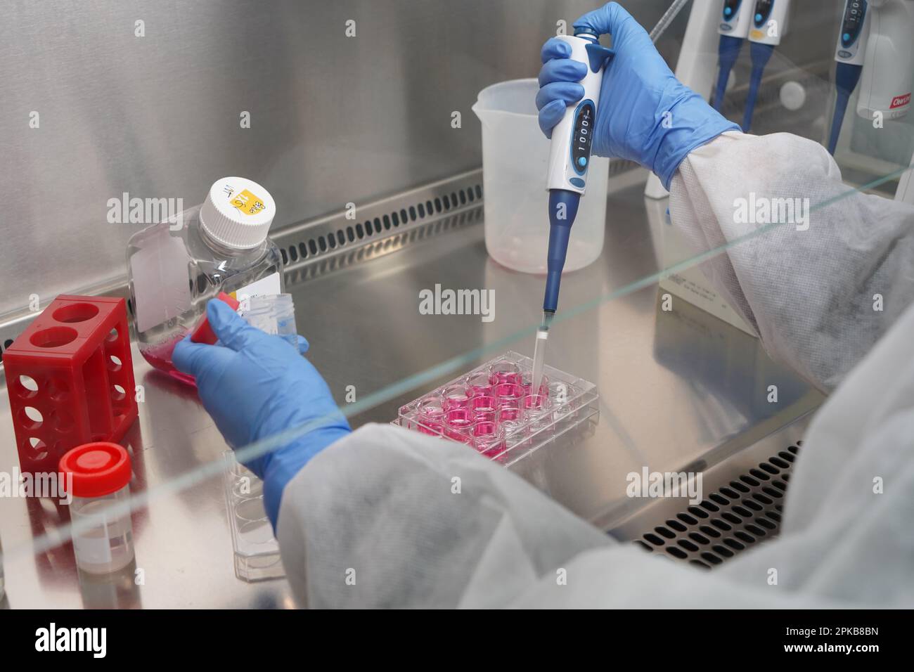 Research on chronic bacterial infections within Inserm. PhD student ...