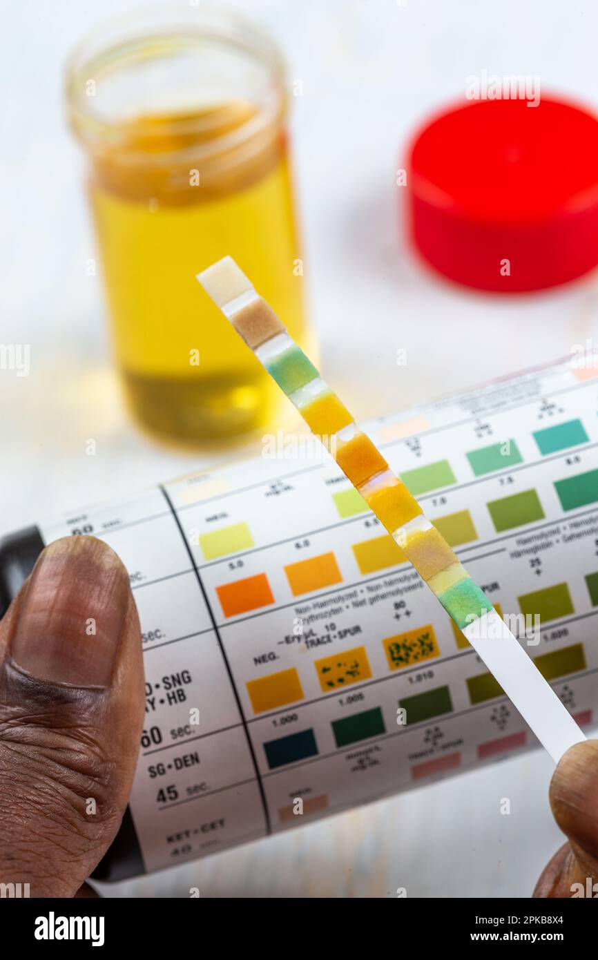 Urinalysis hi-res stock photography and images - Alamy