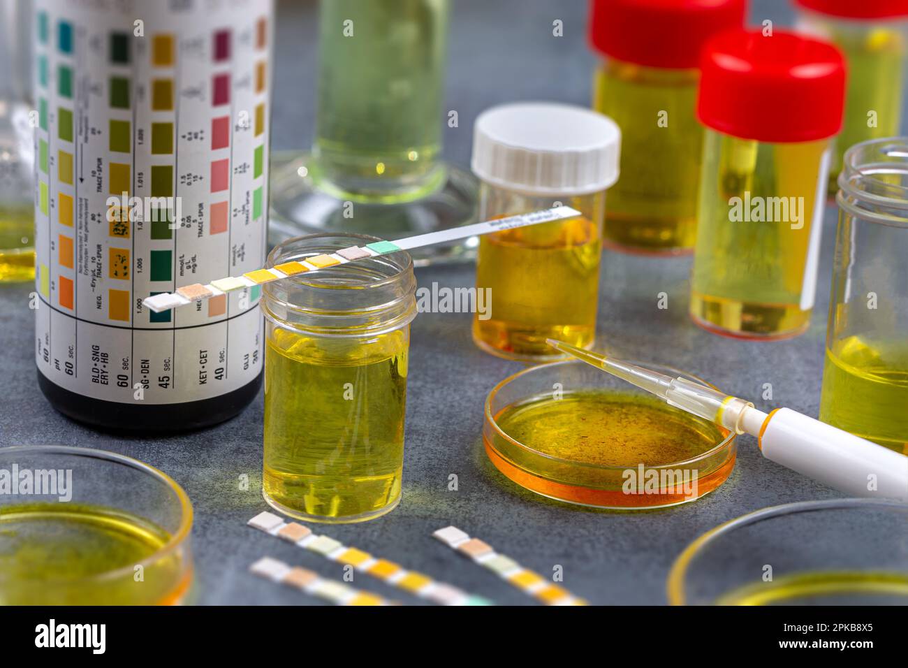 Conceptual image about urinalysis Stock Photo - Alamy