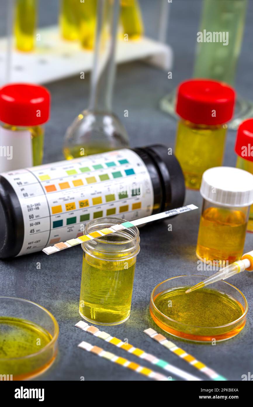 Conceptual image about urinalysis Stock Photo - Alamy