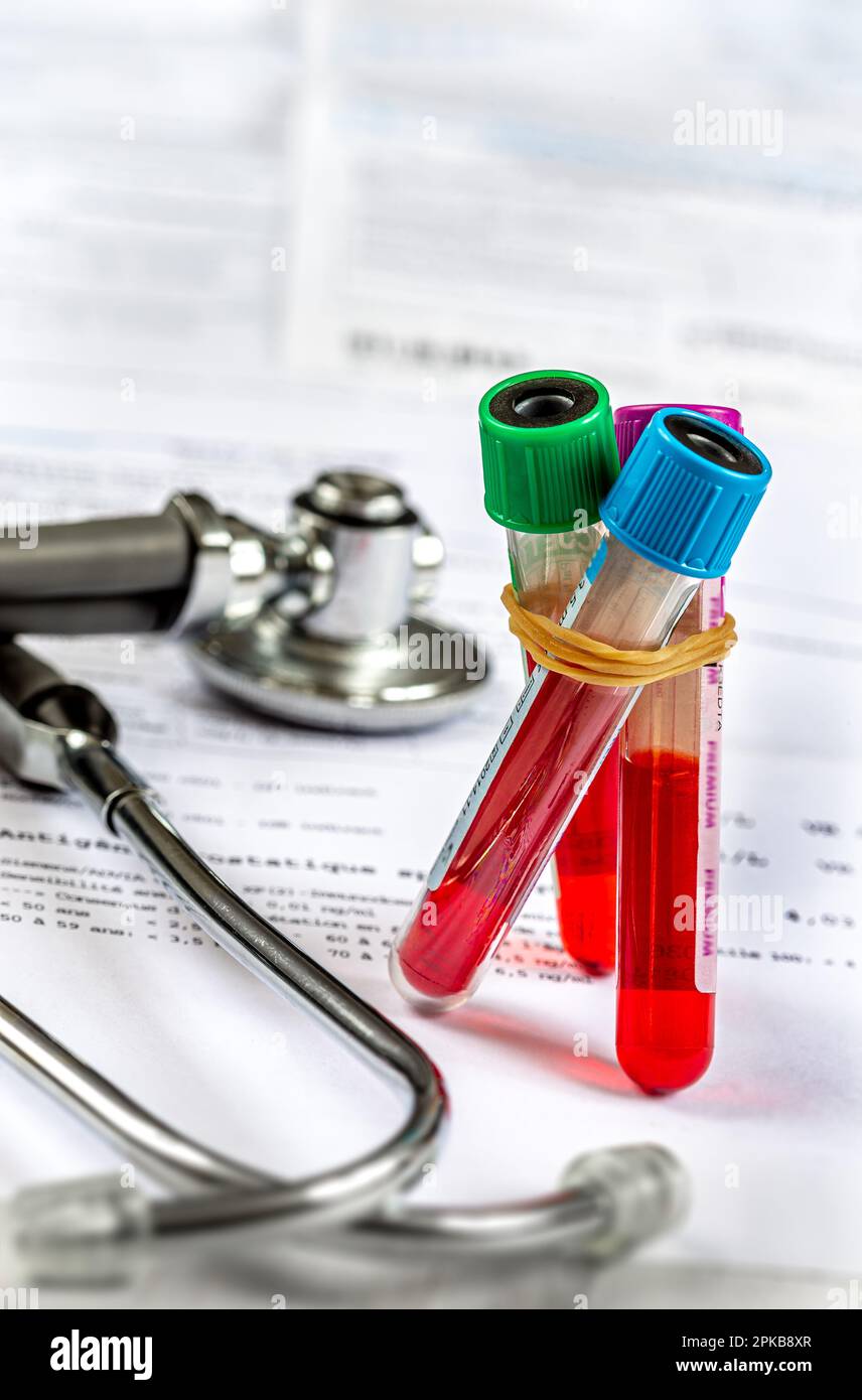 Blood tubes and stetoscope placed on test results Stock Photo - Alamy