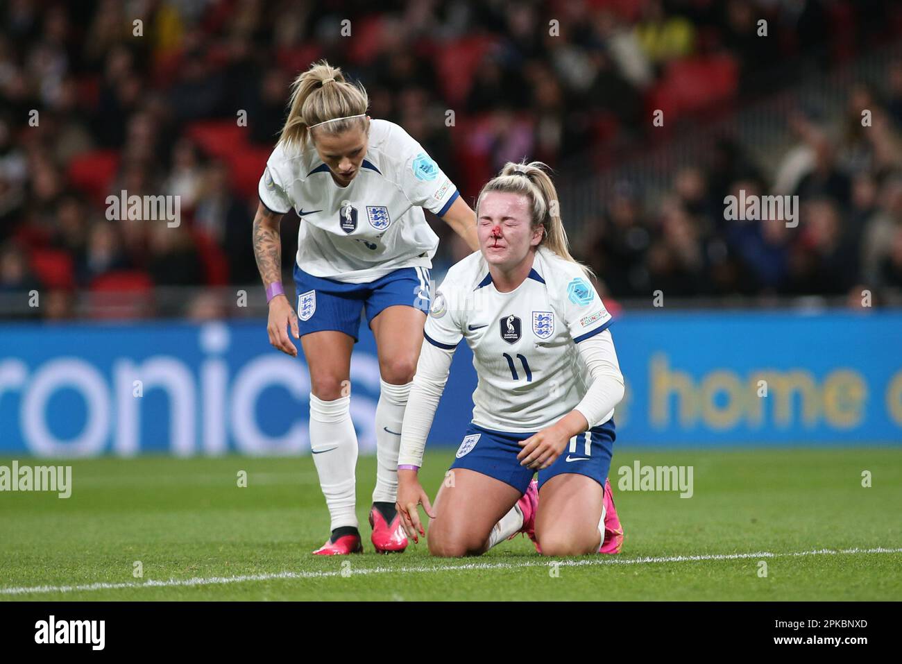 London, UK. 06th Apr, 2023. Lauren Hemp (11 England) bleeding nose ...