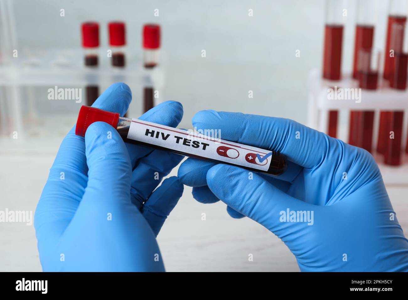 Hand holding hiv test hi-res stock photography and images - Alamy