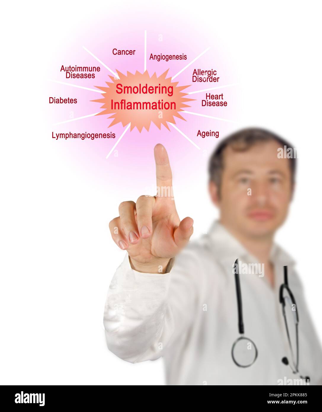 Presenting Consequences of Smoldering Inflammation Stock Photo - Alamy