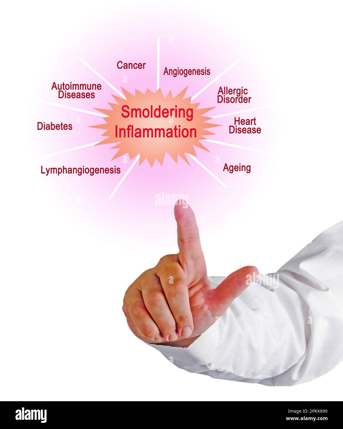 Presenting Consequences of Smoldering Inflammation Stock Photo - Alamy