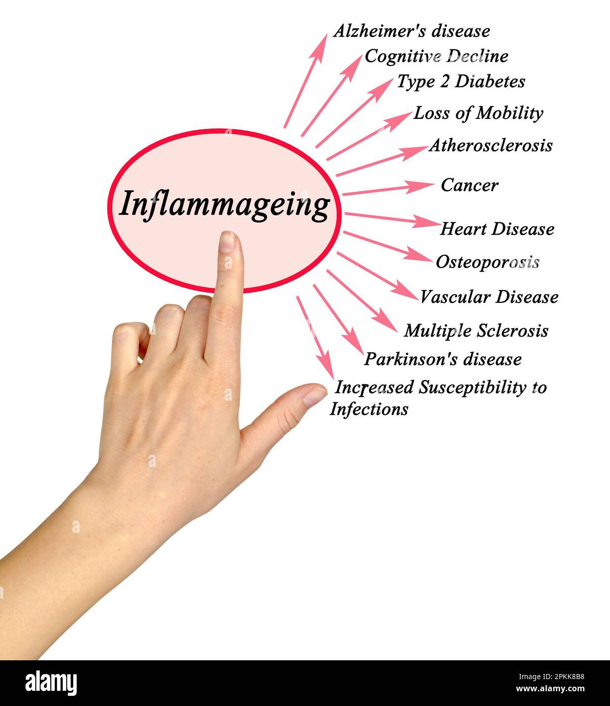 Woman Presenting Consequences of Inflammageing Stock Photo - Alamy